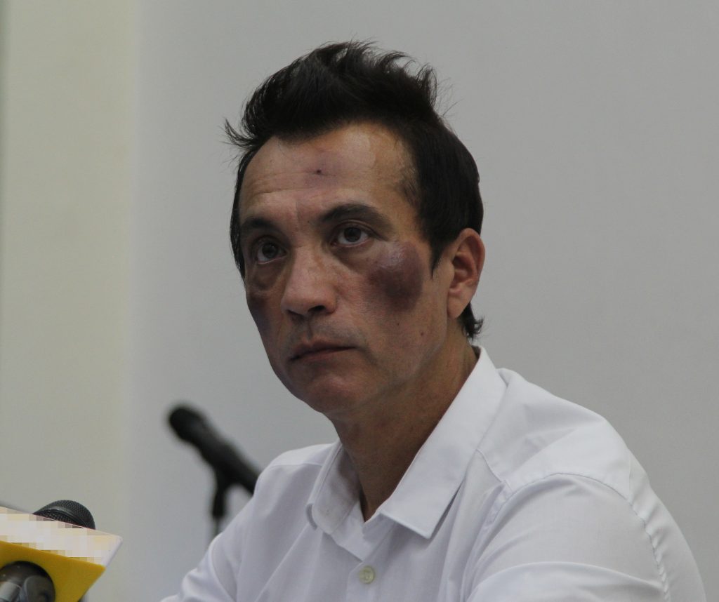 Tras ‘mentiras’ sobre incidente, Angulo renuncia como secretario de ...