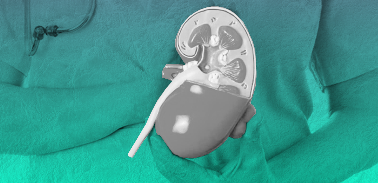 Día del riñón: 4 claves sobre este órgano, sus cuidados y ...